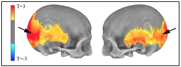 Skull Shape Changes Related to [IMAGE] | EurekAlert! Science News Releases