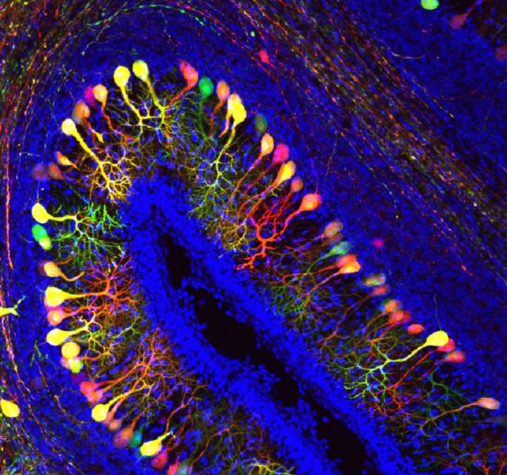 Purkinje Cells [IMAGE] | EurekAlert! Science News Releases