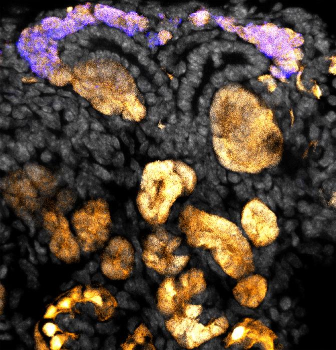 Mouse kidney nephron progenito [IMAGE] | EurekAlert! Science News Releases