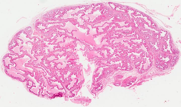 Scientists discover microbiome that may be re | EurekAlert!