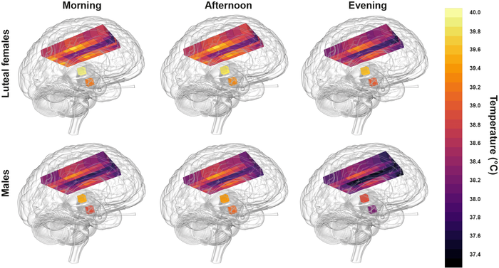 Healthy human brain temperatur [IMAGE] | EurekAlert! Science News Releases