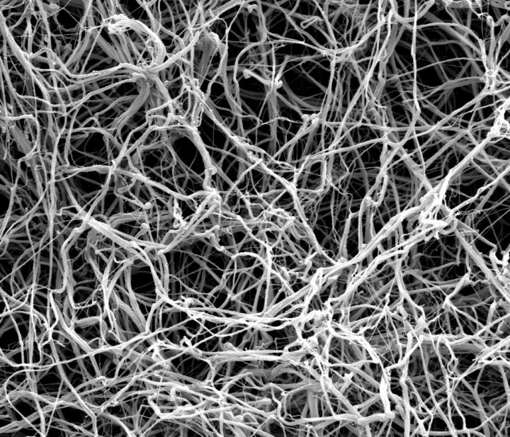 Fibrin fibres [IMAGE] | EurekAlert! Science News Releases