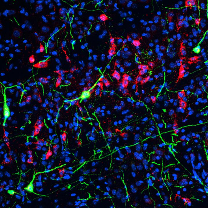 Uncovered: Neurons that Influence Stressed Ve | EurekAlert!