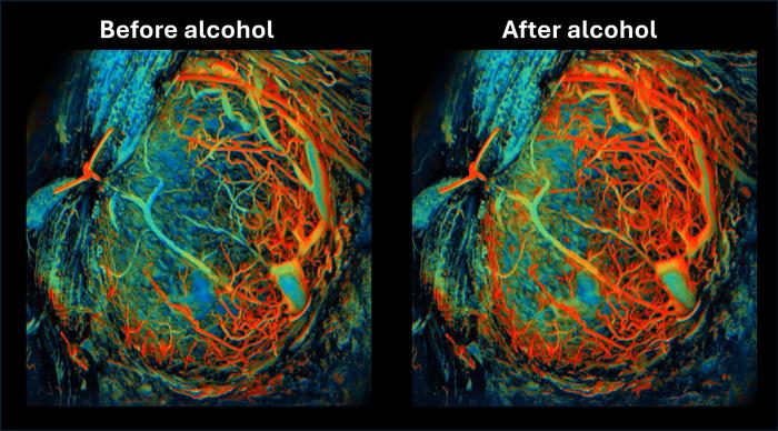 Alcohol consumption [IMAGE] | EurekAlert! Science News Releases