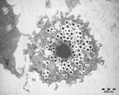 Mimivirus Infects Amoeba [IMAGE] | EurekAlert! Science News Releases