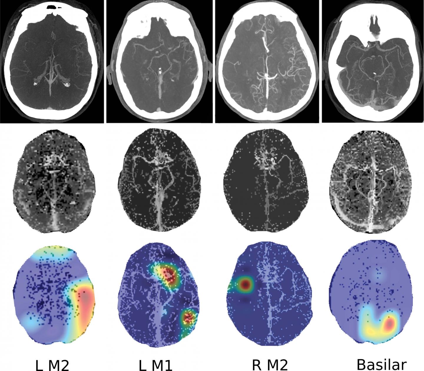 Deep learning model provides rapid detection | EurekAlert!