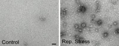 Protein Tangles [IMAGE] | EurekAlert! Science News Releases