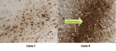 Clade B HIV vs. Clade C HIV [IMAGE] | EurekAlert! Science News Releases