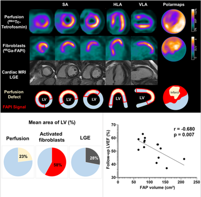 SNMMI 2022 Image of the Year [IMAGE] | EurekAlert! Science News Releases