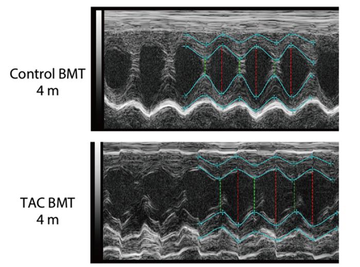 Understanding a broken heart | EurekAlert!