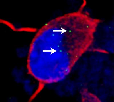 Toxic RNA Foci in C9ORF72 iPS [IMAGE] | EurekAlert! Science News Releases
