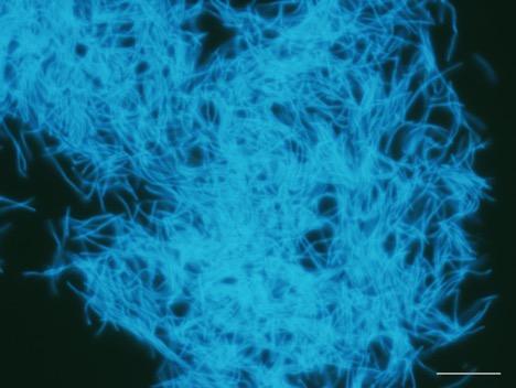 Methanobacterium [IMAGE] | EurekAlert! Science News Releases