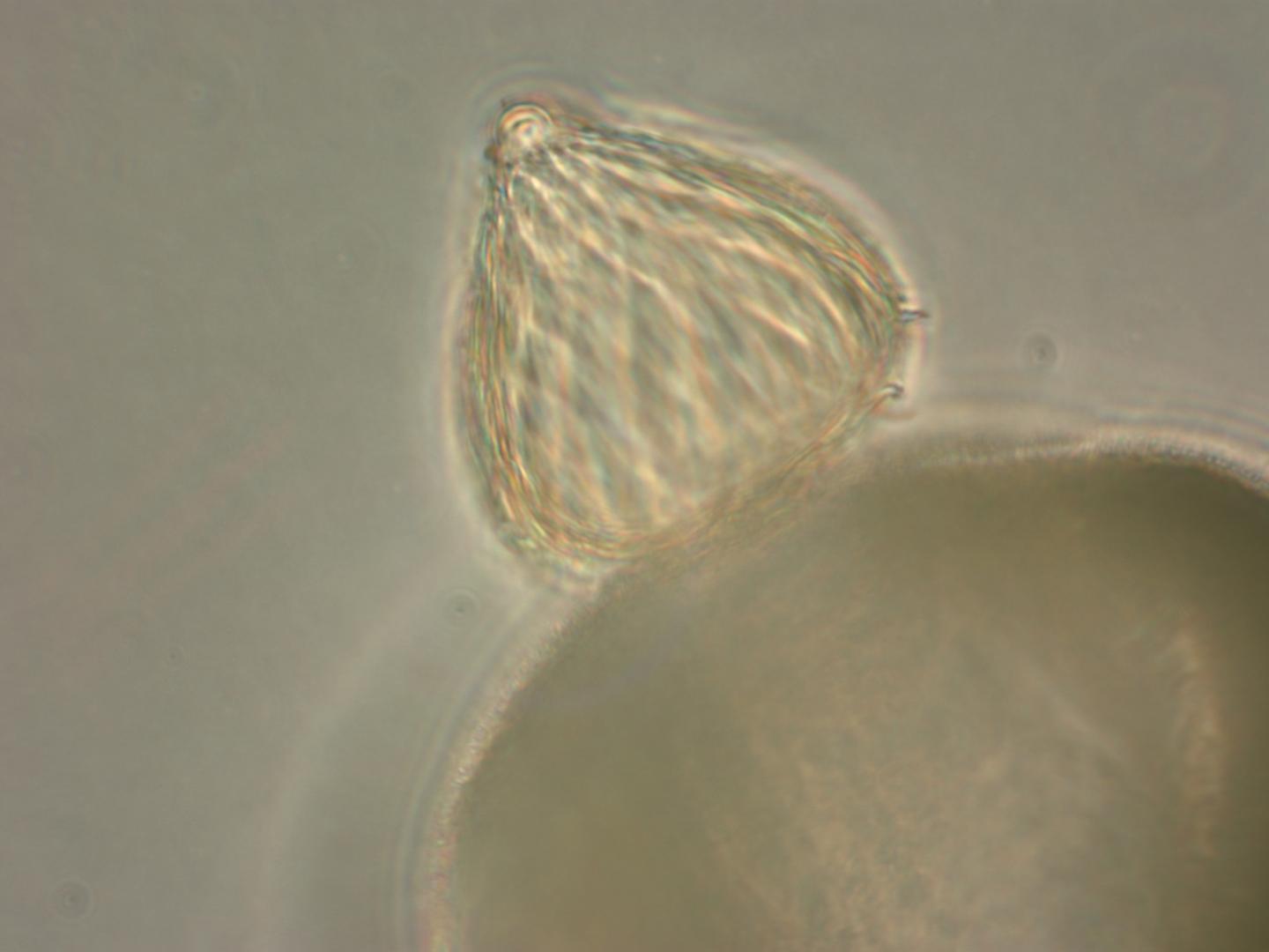 Blyttiomyces helicus Fu [IMAGE] | EurekAlert! Science News Releases