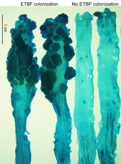 ETBF Colons [IMAGE] | EurekAlert! Science News Releases