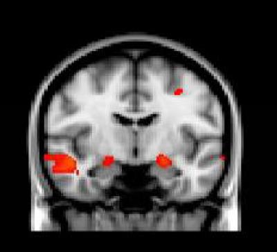 Brain Scan [IMAGE] | EurekAlert! Science News Releases