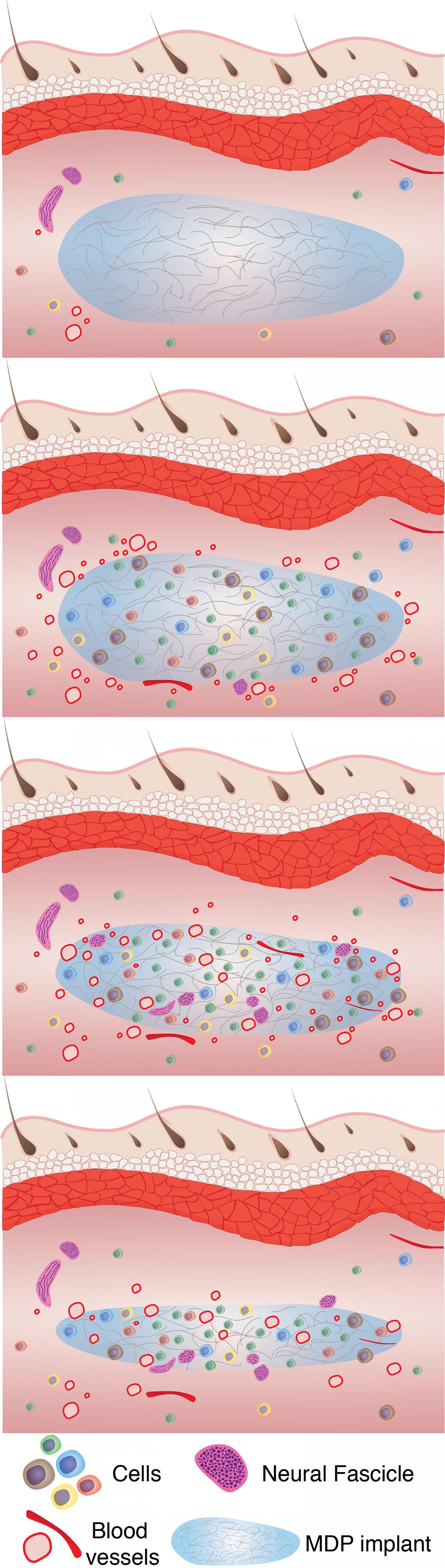 Hydrogel Development [IMAGE] | EurekAlert! Science News Releases