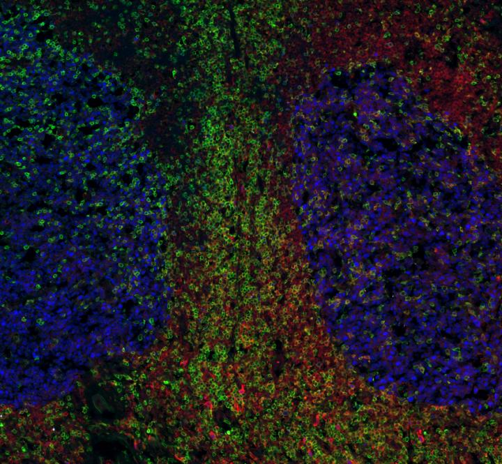 Human Tonsil Section [IMAGE] | EurekAlert! Science News Releases