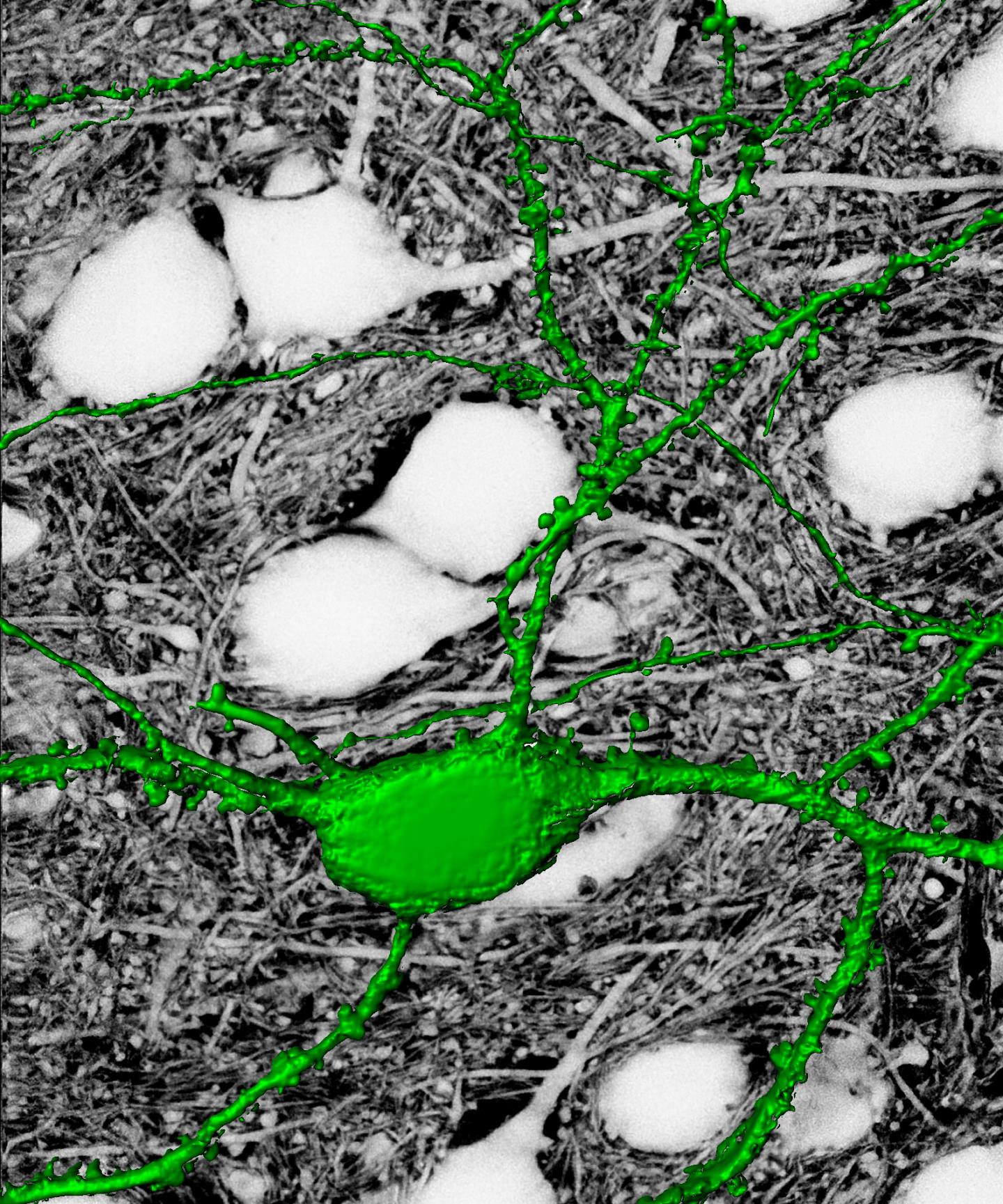 A look at the space between mouse brain cells | EurekAlert!