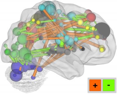A Look at the Human Brain, Over Time (4 of 4) | EurekAlert!