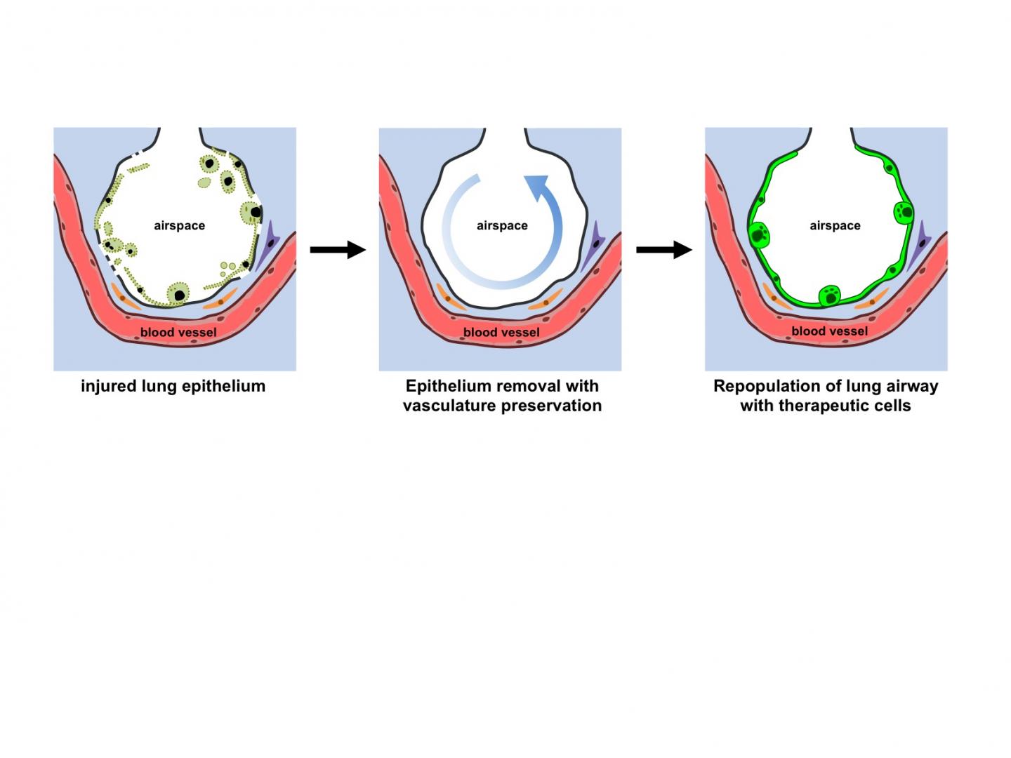 Functional Vascularized Graft [IMAGE] | EurekAlert! Science News Releases