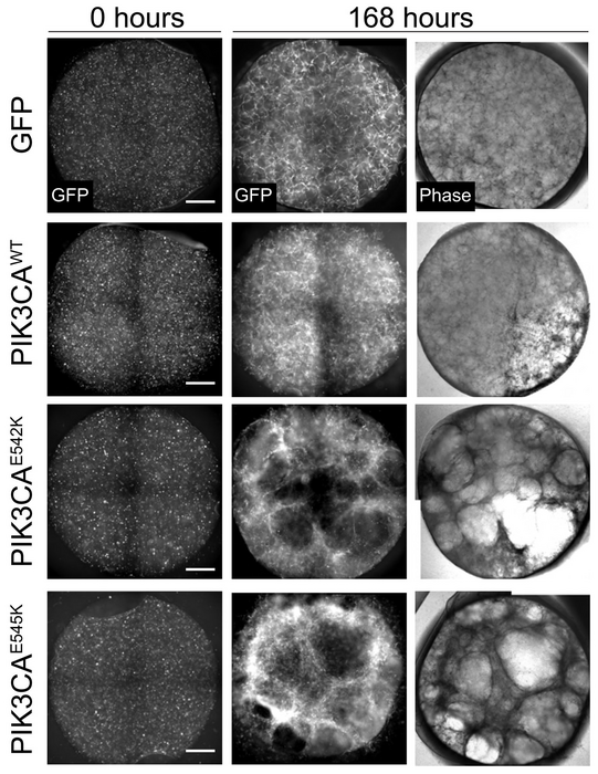 Endothelial cells [IMAGE] | EurekAlert! Science News Releases