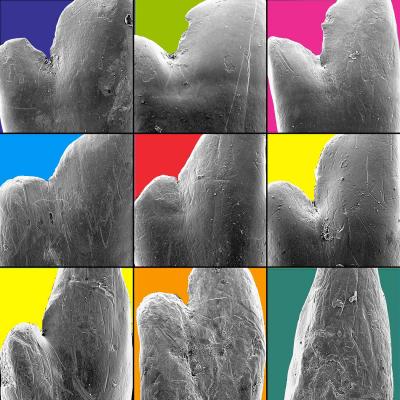 Haplochromine Cichlid Teeth [IMAGE] | EurekAlert! Science News Releases