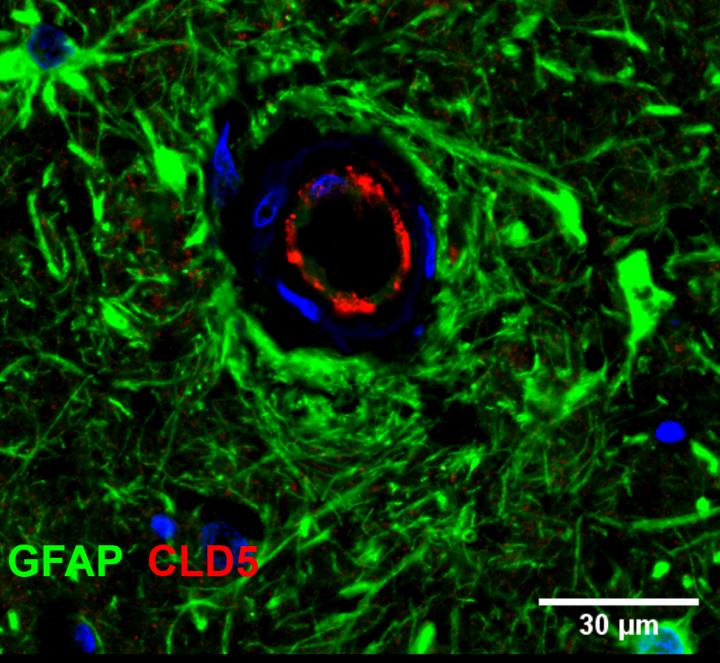 Glial fibrillary acidic protei [IMAGE] | EurekAlert! Science News Releases