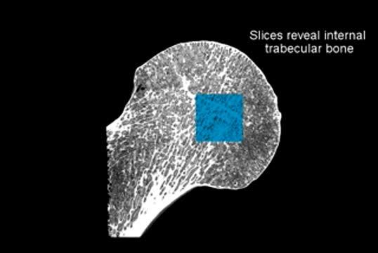 Fragile bones of modern humans result from re | EurekAlert!