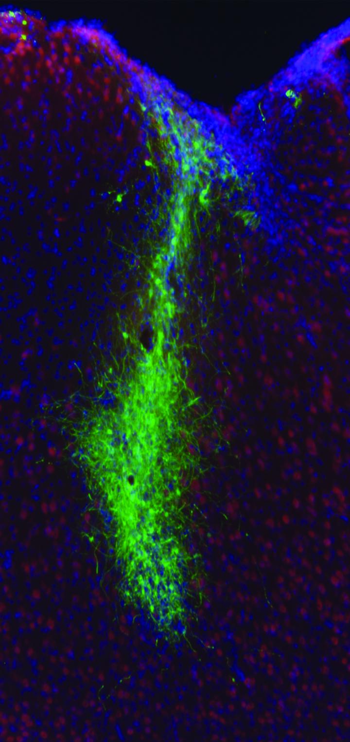 Cells Injected into Brain [IMAGE] | EurekAlert! Science News Releases