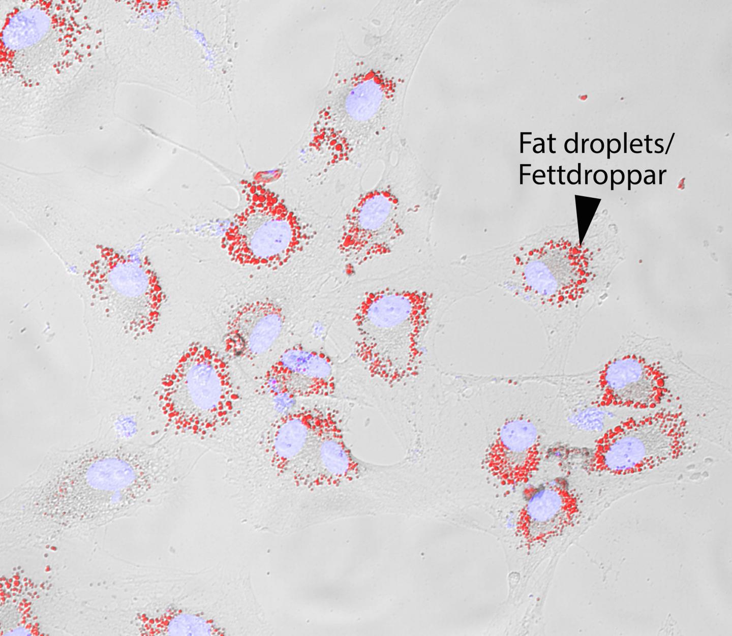 Cancer Cells and Fat Droplets [IMAGE] | EurekAlert! Science News Releases