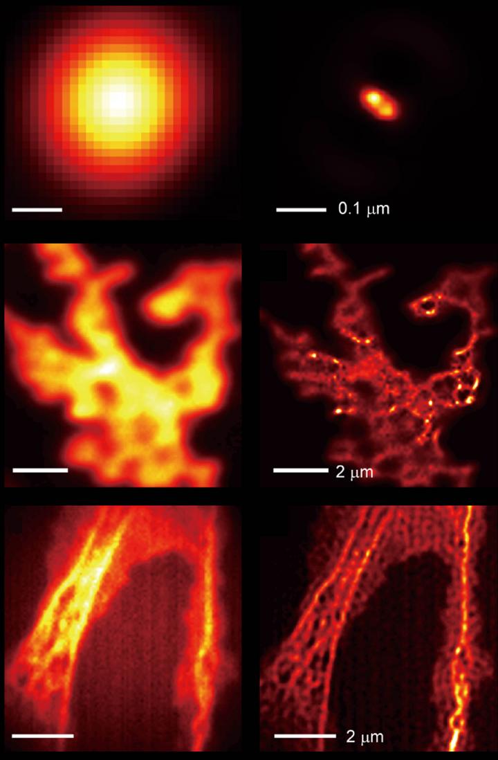 Super resolution microscope sl [IMAGE] | EurekAlert! Science News Releases