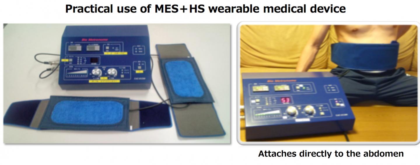 The MES+HS Wearable Medical De [IMAGE] | EurekAlert! Science News Releases
