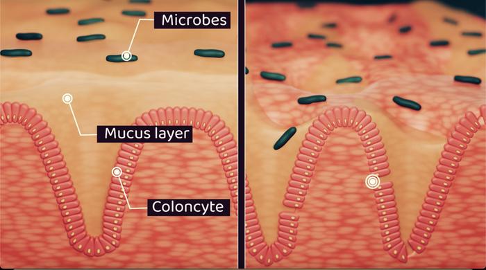 Image depicts a healthy versus [IMAGE] | EurekAlert! Science News Releases