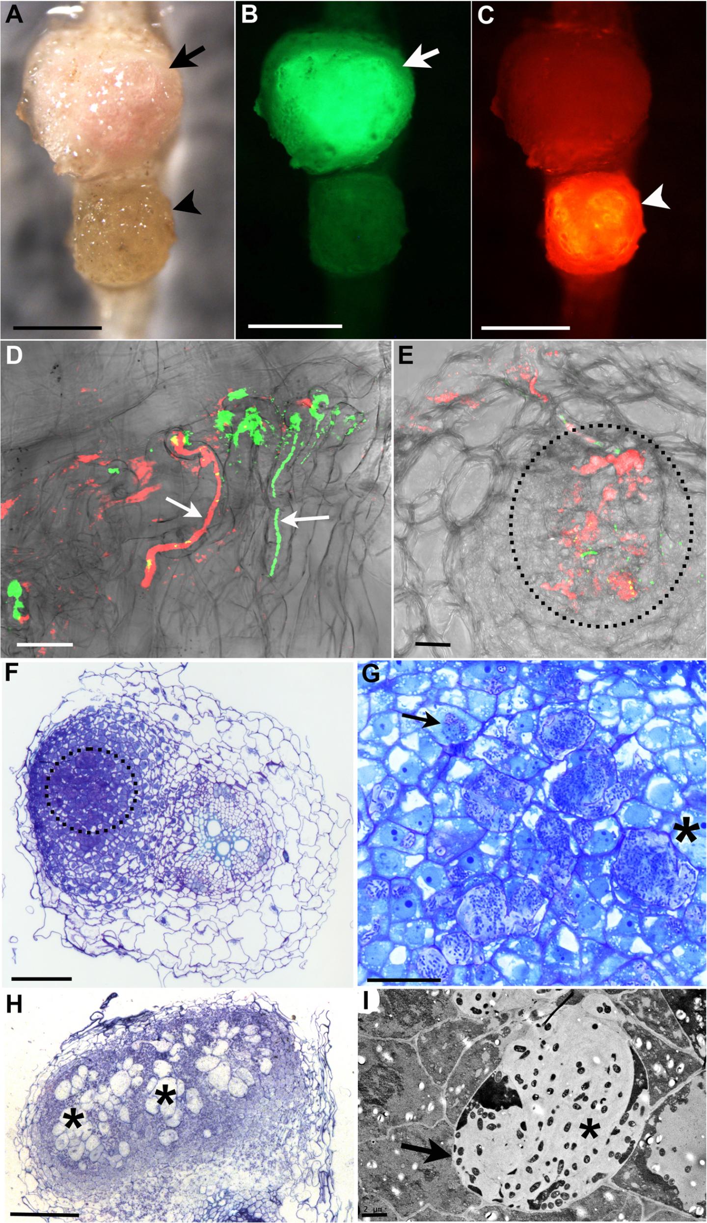Legumes control infection of nodules by both | EurekAlert!