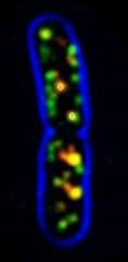 New View of Elongating Bacteria (2 of 5) | EurekAlert!
