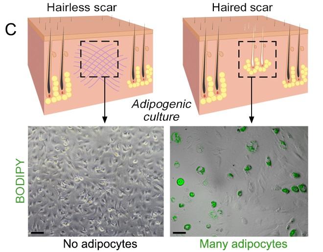 A Comparison of Scars [IMAGE] | EurekAlert! Science News Releases