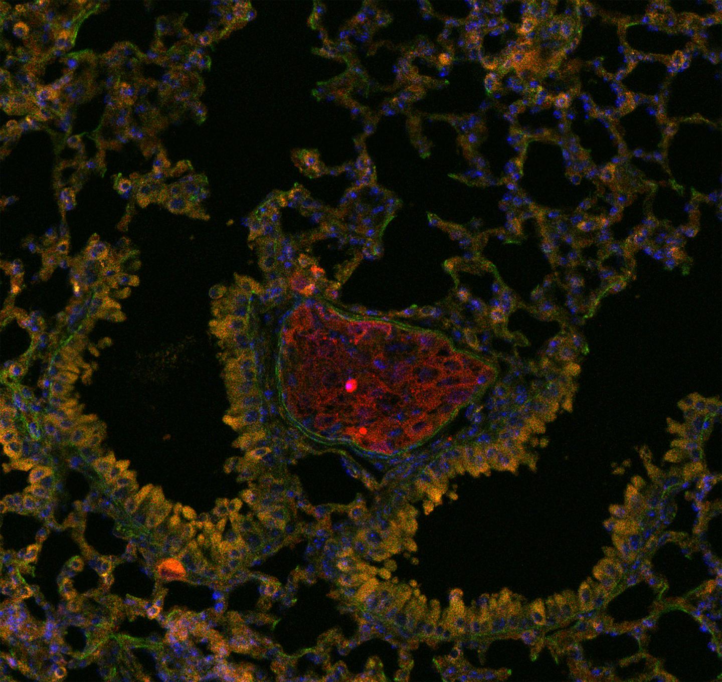 Nesting in Pre-Metastatic Nich [IMAGE] | EurekAlert! Science News Releases