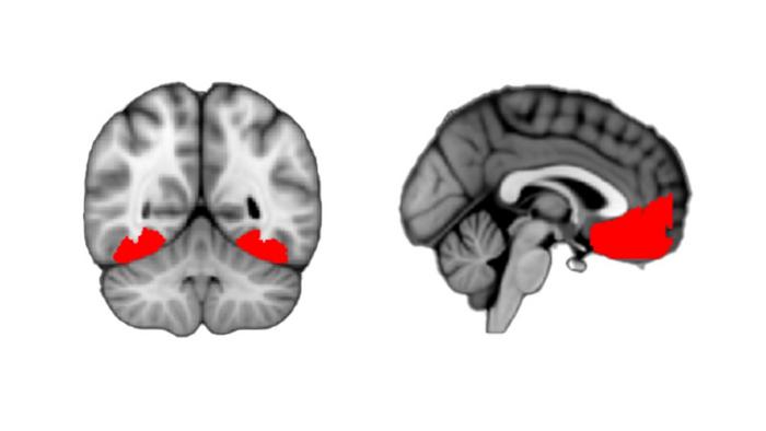 Brain-imaging study reveals curiosity as it e | EurekAlert!