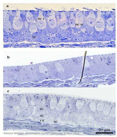 Balance Organ Hair Cells [IMAGE] | EurekAlert! Science News Releases