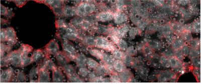 Mouse Liver [IMAGE] | EurekAlert! Science News Releases