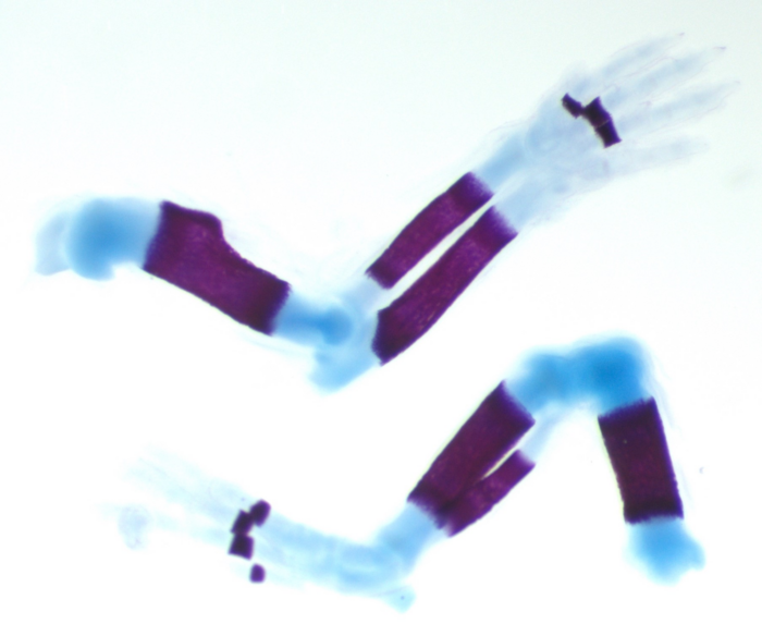 Pioneering new strategy lengthens limbs to tr | EurekAlert!