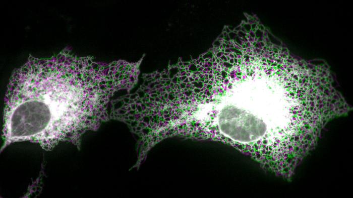 the endoplasmic reticulum [IMAGE] | EurekAlert! Science News Releases