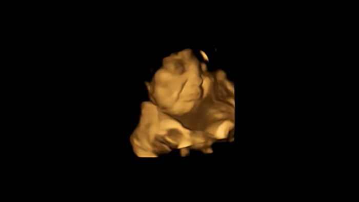 Cry-face reaction scan image.j [IMAGE] | EurekAlert! Science News Releases