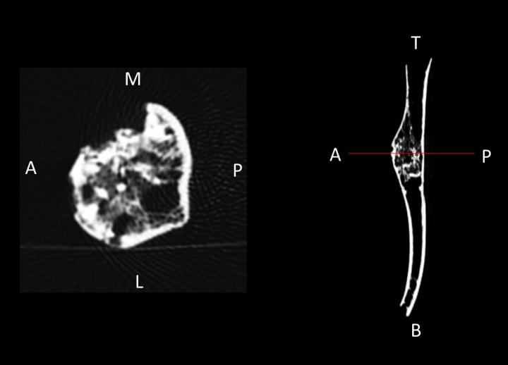 Right Humerus CT Scan [IMAGE] | EurekAlert! Science News Releases