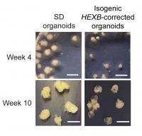 Sandhoff disease study shows proof of princip | EurekAlert!