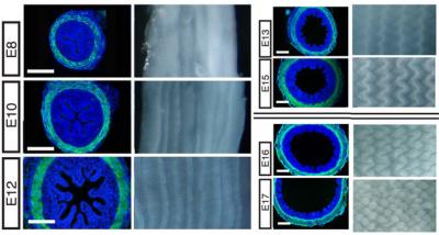 Villi Form Patterns within the [IMAGE] | EurekAlert! Science News Releases