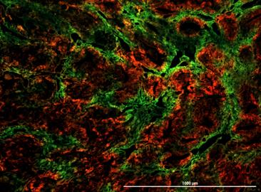 Hypoxic Cells [IMAGE] | EurekAlert! Science News Releases