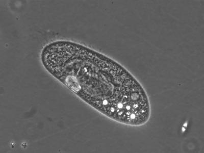 Paramecia [IMAGE] | EurekAlert! Science News Releases