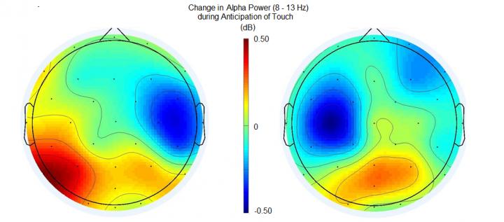Brain Scan Image [IMAGE] | EurekAlert! Science News Releases