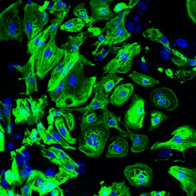 Cardiomyocytes [IMAGE] | EurekAlert! Science News Releases